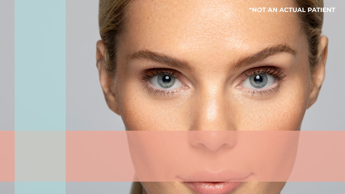 Feeling Let Down by Low-Lying Eyelids? – Upneeq